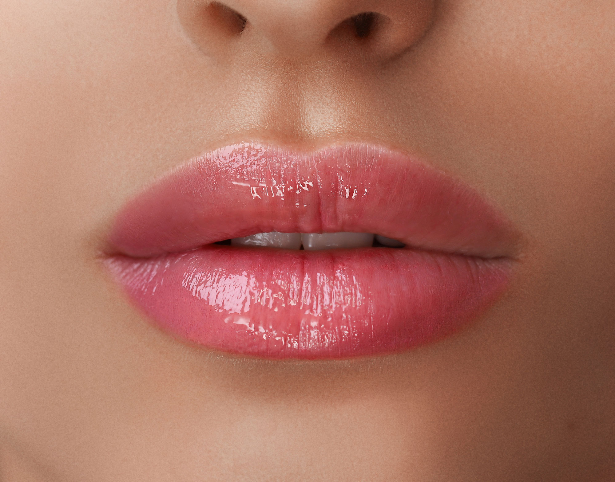 Lip Lift – TOKAI CLINIC